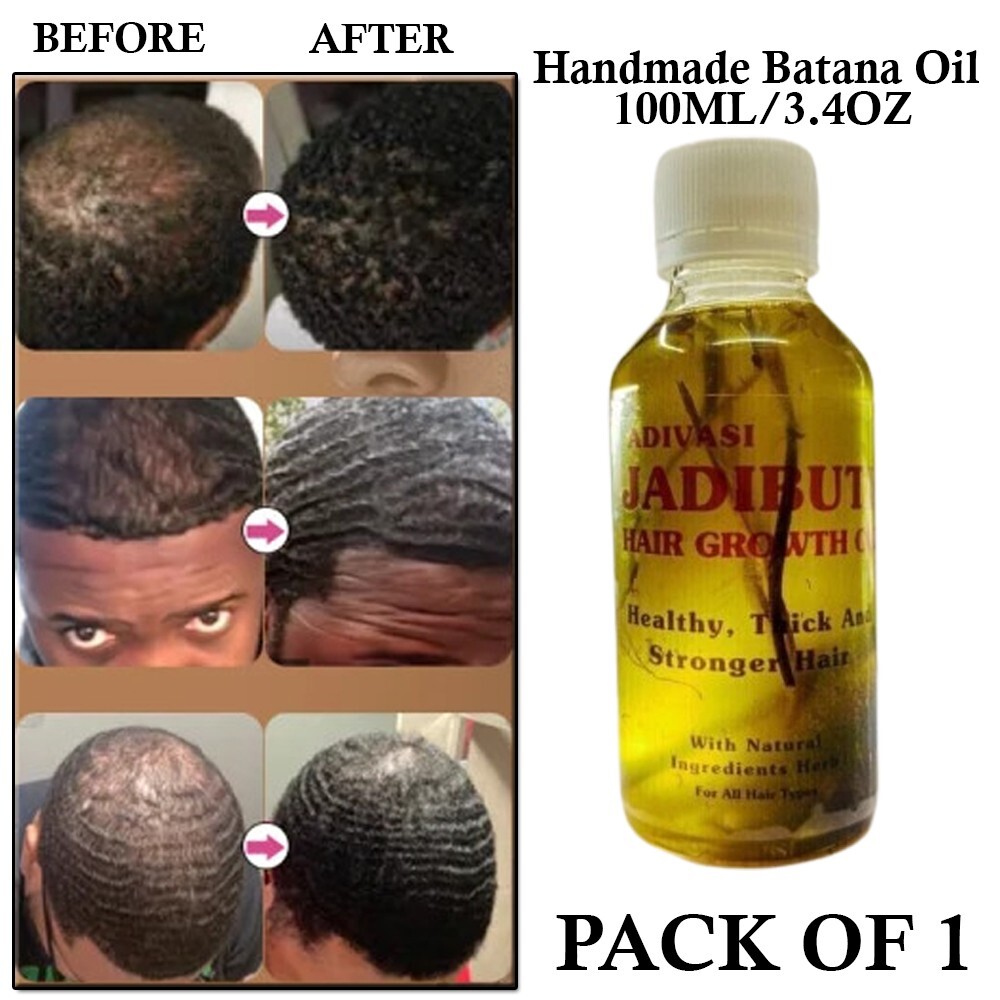 100% ORGANIC BATANA OIL FROM HONDURAS The Real One Only Come From ...