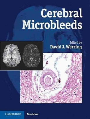 Cerebral Microbleeds: Pathophysiology to Clinical Practice by David J ...