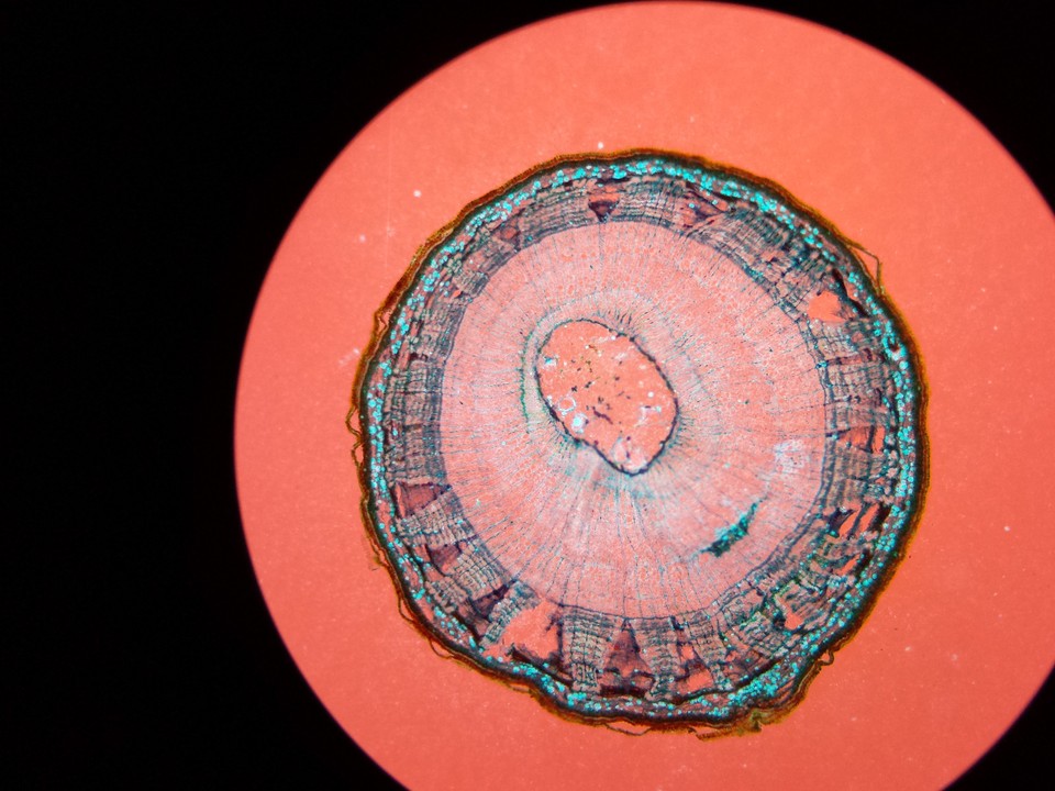 Microscope 32mm Rheinberg Filters Set With Darkfield Lighting ...