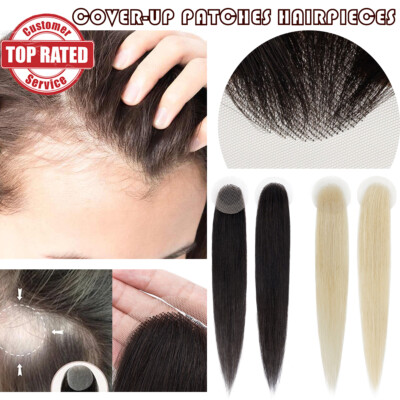 UK Human Hair Patches Pieces Full Skin Base Cover Bald Spots for ...