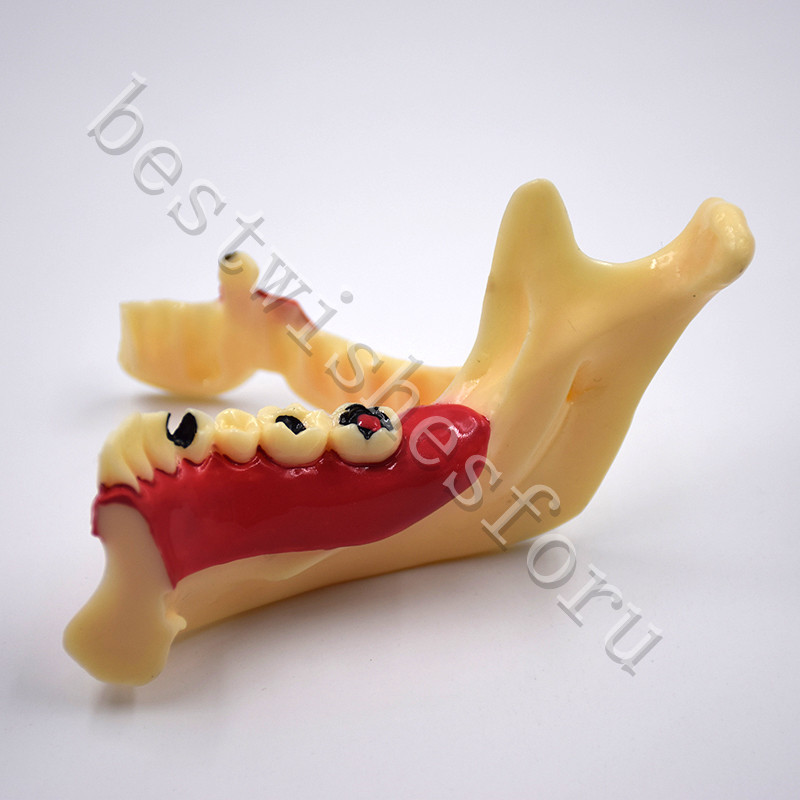 Dental Teeth Low Jaw Bone Tissue Mandible Anatomical Jawbone Mandibular ...
