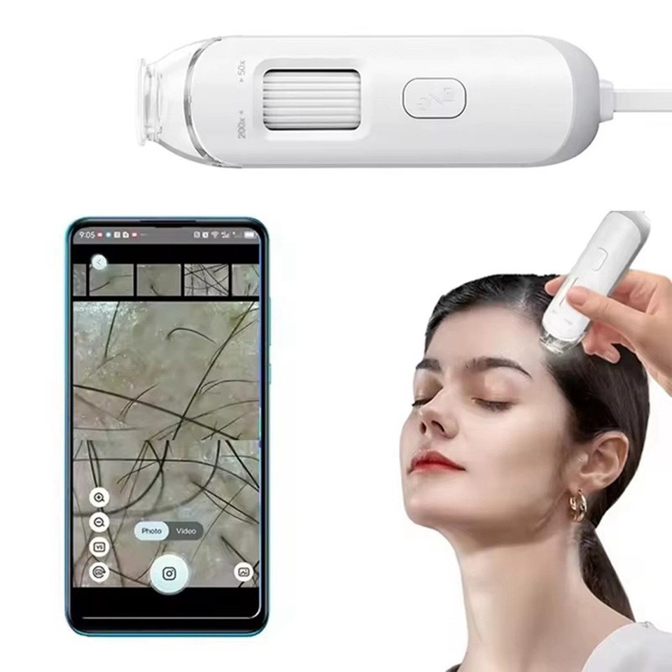 Electron Dermatoscope Scalp Camera Detection Professional Skin6388 ...