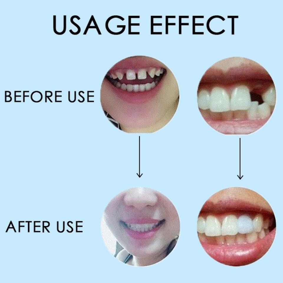 10/100g Dental Glue Handmade Solid Denture Glue Tooth Beauty Tool (100g ...