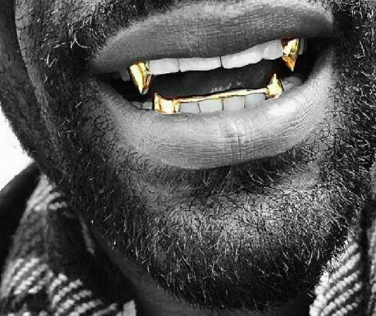 14K Gold Plated Upper Top Single Fangs & Lower Teeth Bridge Fang Grillz ...