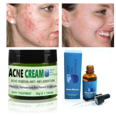 2 in 1 Anti Acne Pimple Remover Cream + Anti - Acne Face Serum Scar ...