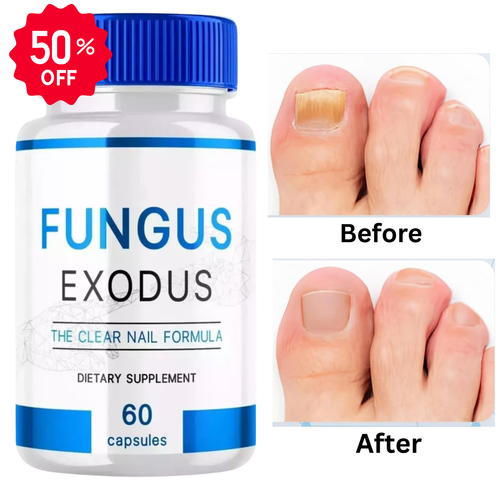 Fungus Exodus Pills to Combat Toenail Fungus and Nail Health 60 ...