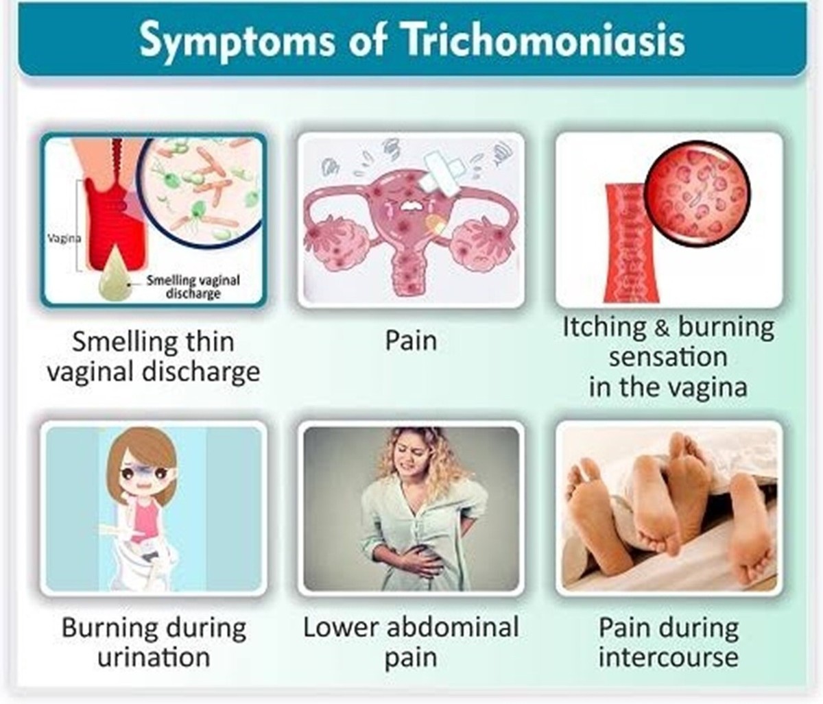Signs Of Trichomoniasis Discharge