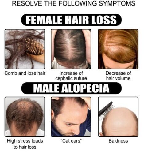 BEST Remedy for Scalp & Body FUNGAL INFECTION Impetigo - HERBAL EXTRACT ...