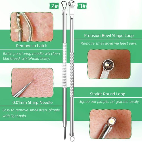 5PCS Blackhead Remover Comedone Extractor, Curved Blackhead Tweezers ...