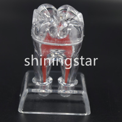 Dentist Dental Crystal Base Hard Plastic Teeth Tooth Molar Model ...