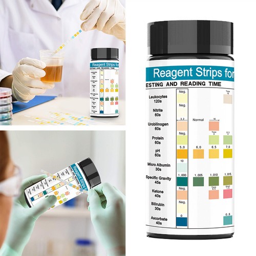 100 Strips Urinalysis Dip-Stick 10 Parameters Protein Test Strips PH ...