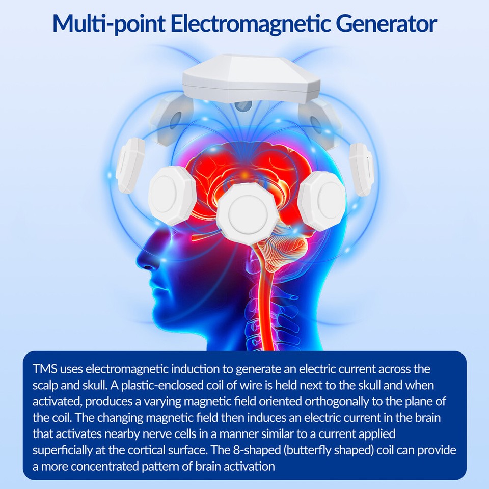 RTMS Transcranial Magnetic Stimulator Device for Depression Anxiety ...