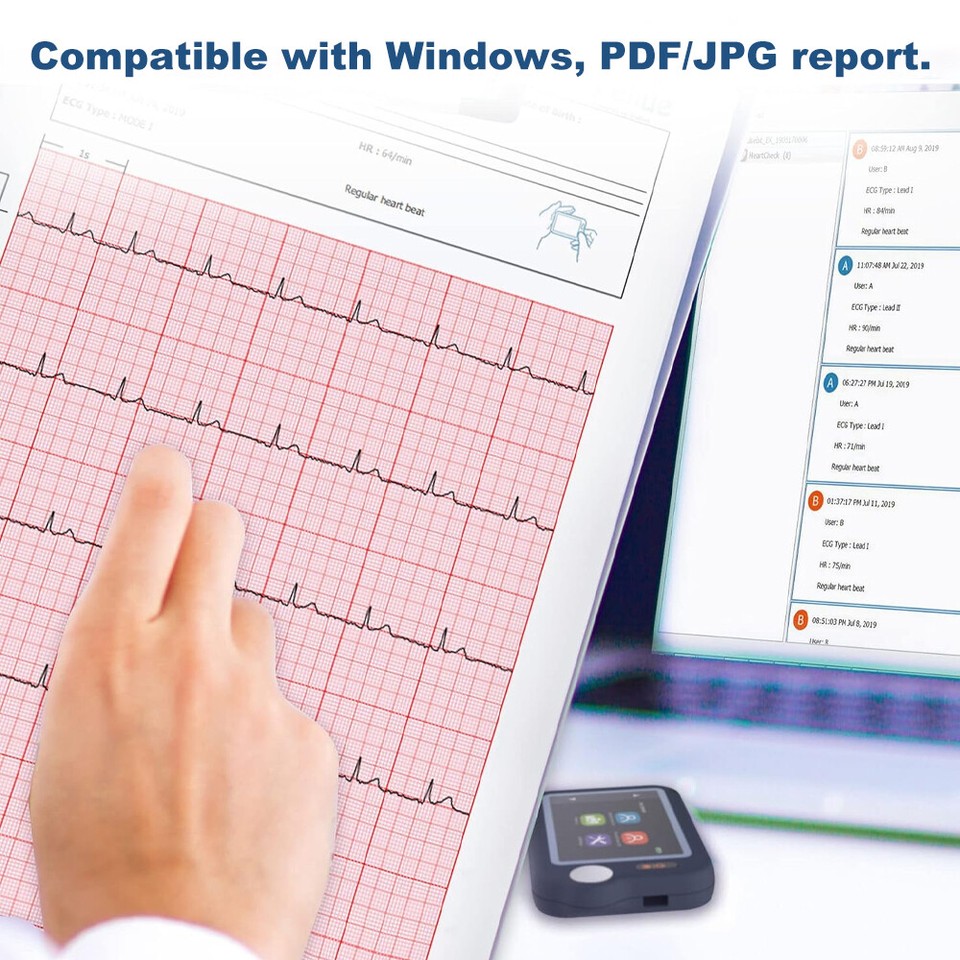 Touch Screen EKG Monitor Heart Monitor with ECG Cable AI-ECG Analysis ...