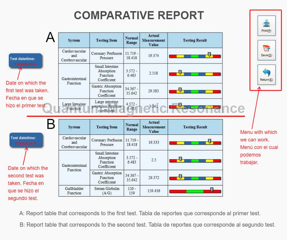 2024 Quantum Magnetic Resonance Body Analyzer 100 Reports -Standard ...