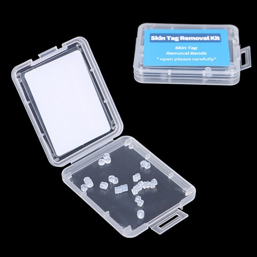 30Pcs Skin Tag Removal Rubber Bands Micro Band Non Toxic Face Care Mole ...