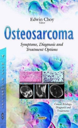 Osteosarcoma: Symptoms, Diagnosis & Treatment Options by Edwin Choy ...