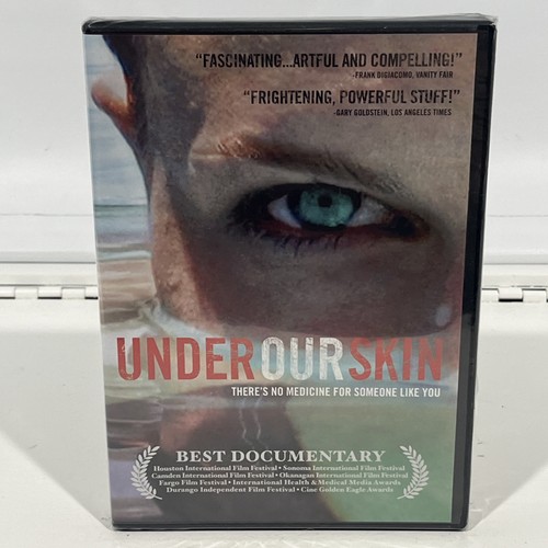 Under Our Skin: A Health Care Nightmare DVD | New Sealed Documentary ...