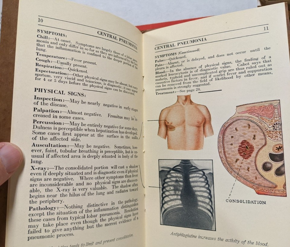 1920 The Pneumonic Lung Physical Signs & Pathology The Denver Chemical ...