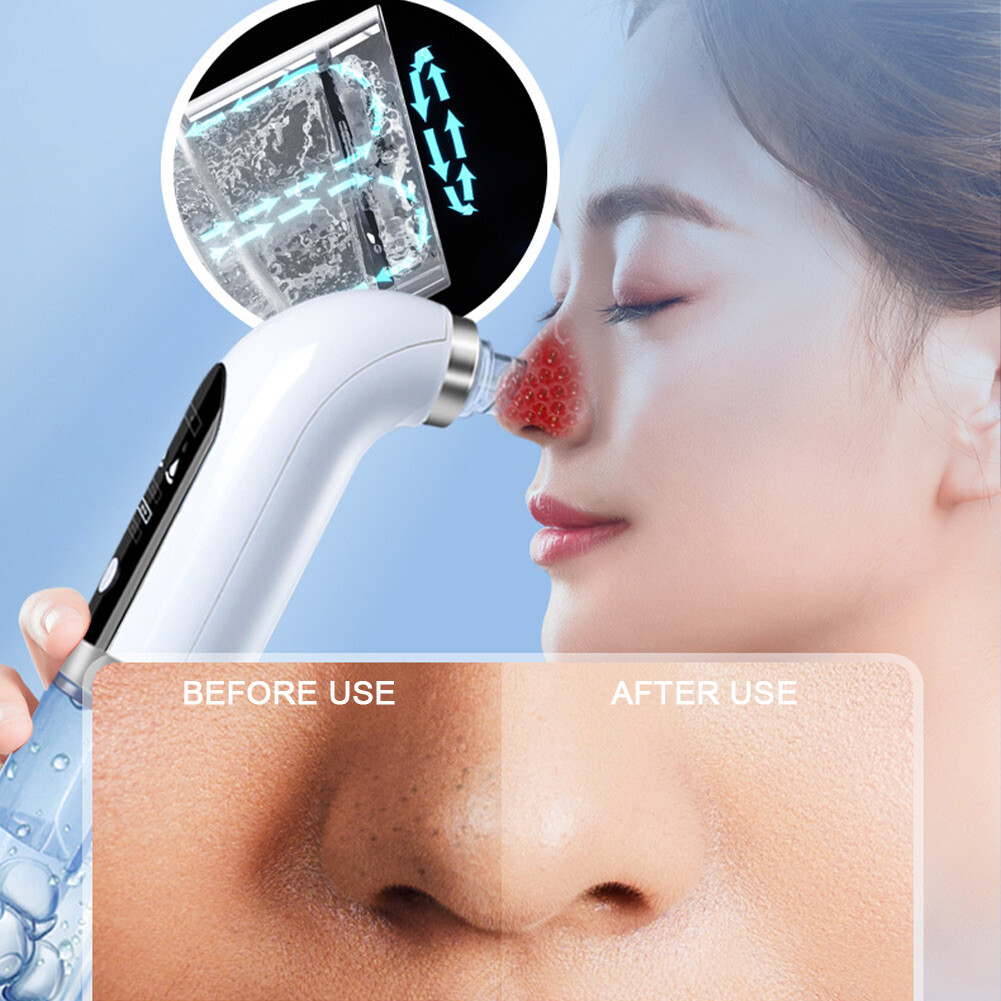 Vacuum Suction Pore Acne Water Cycle Electric Blackhead Remover ABS ...