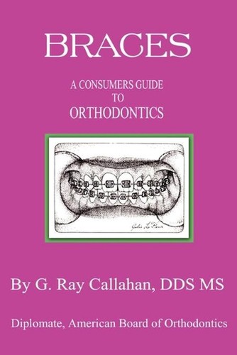 Braces: A Consumers Guide to Orthodontics by G. Ray Callahan (English ...