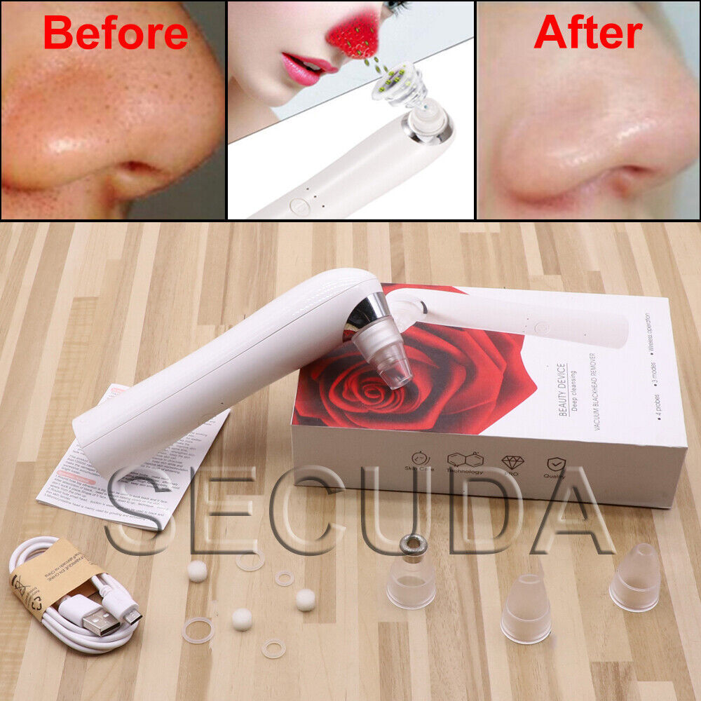 Pore Cleanser Cleaner Face Blackhead Zit Acne Remover Skin Clean Kit ...