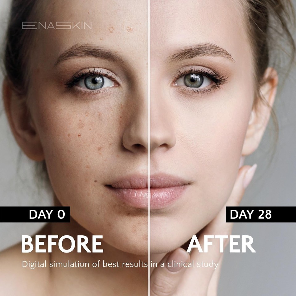 EnaSkin Dark Spot Remover Face & Body Serum: Age Spot Sun Spot Freckles Melasma | eBay