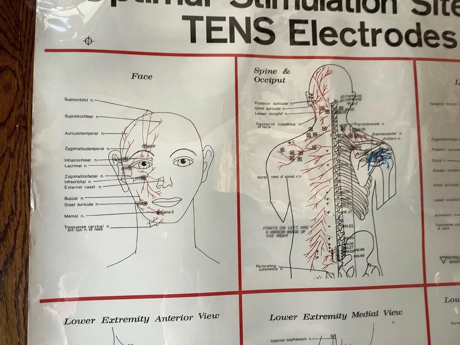 Vintage 1980 Dynex Neurostimulator Stimulation Electrodes Medical Chart ...