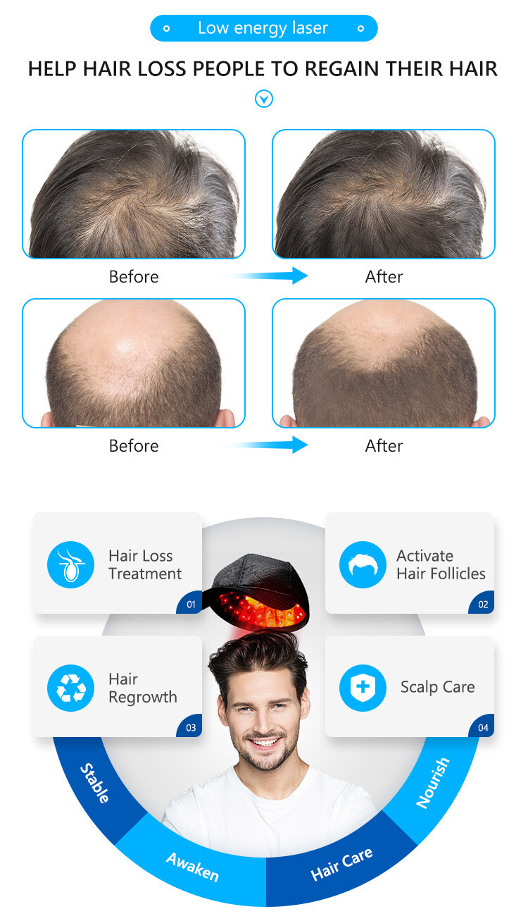 FDA Cleared Hair Growth Laser Cap 208 LED Diodes Hat Rejuvenation ...