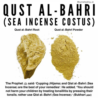 Qust Al Bahri Qust Al Bahri Sea Costus Sunnah Shifa Halal Prophetic Medicine 50g | eBay