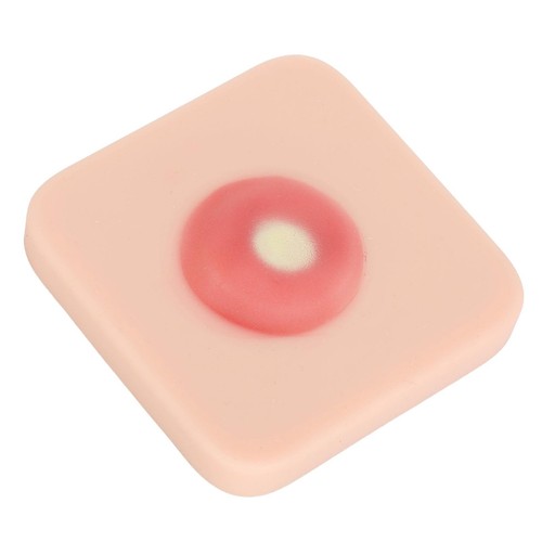 Surgical Training Pad for Abscess Incision Drainage and Sebaceous Cyst ...