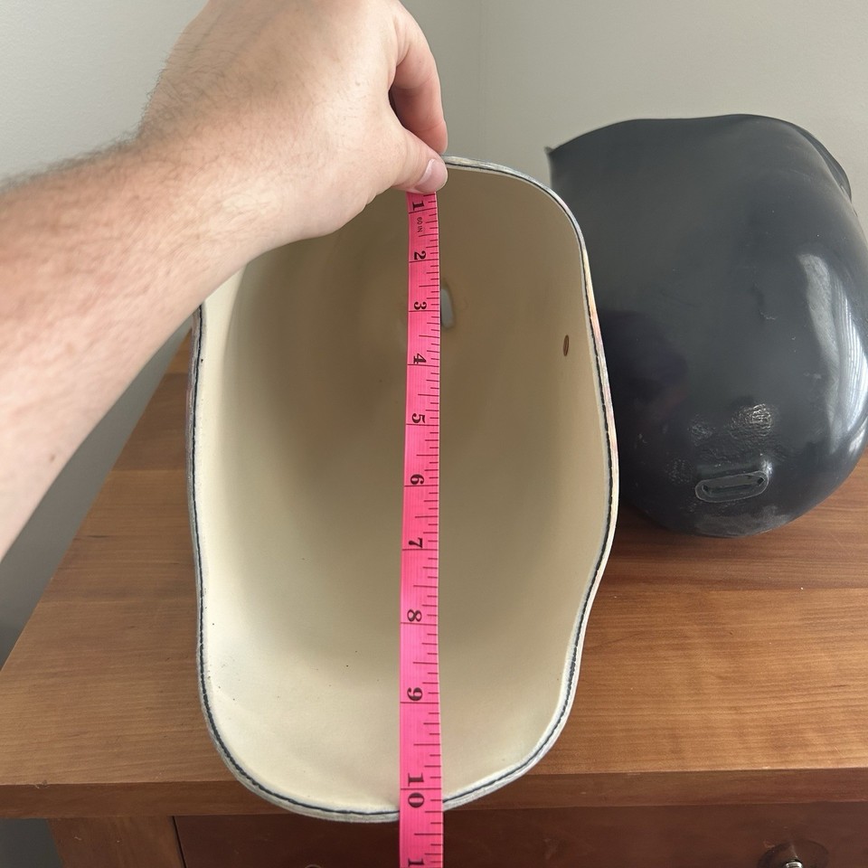 Prosthetic Above The Knee Stubbies Trulife Right And Left Leg With ...