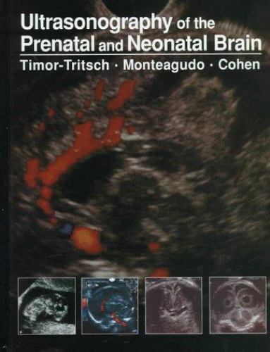 Ultrasound of the Prenatal and Neonatal Brain by Ilan Timor-Tritsch ...