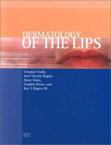 Dermatology of the Lips by Roy S. Rogers, Stephen Porter, Crispian ...
