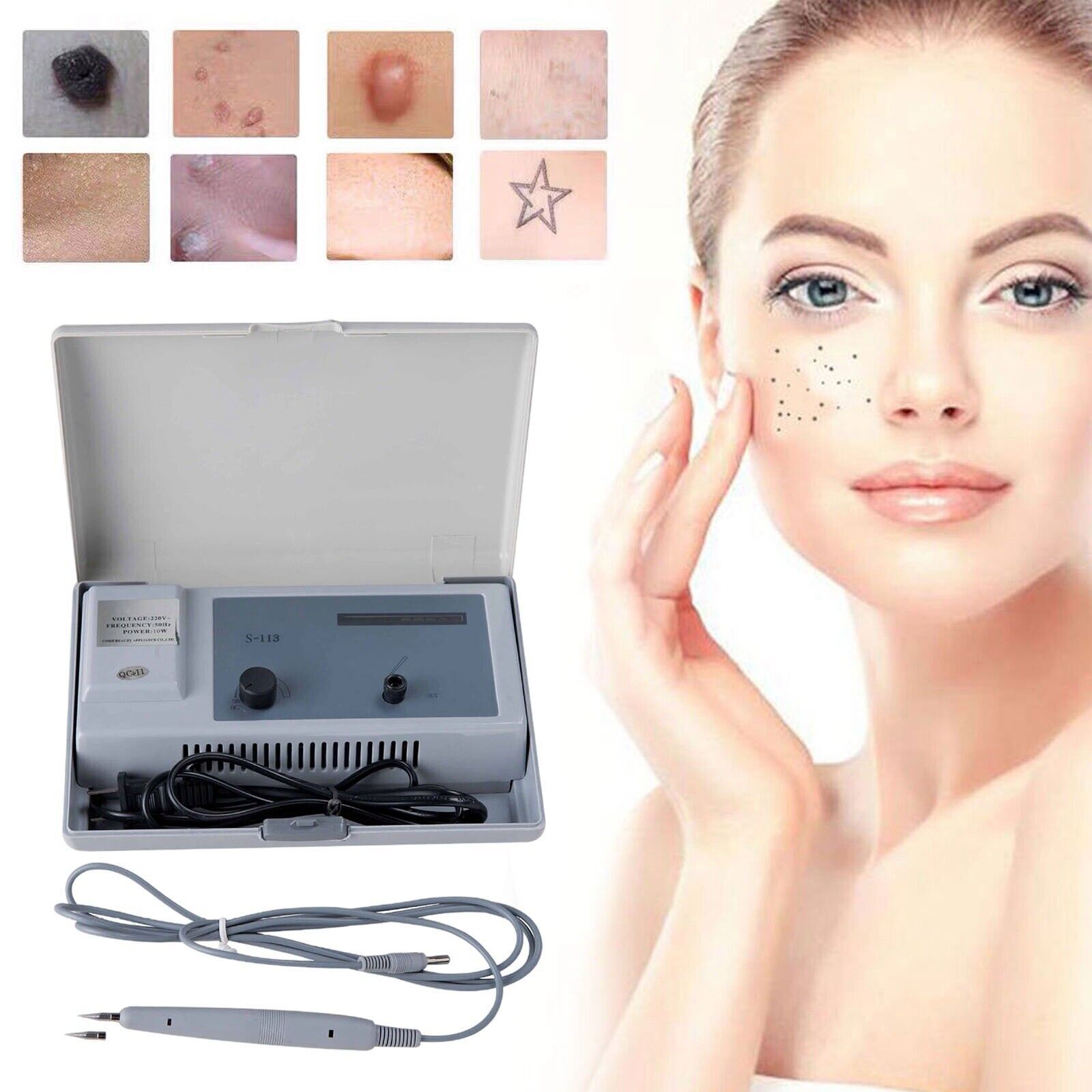 Brand New Portable Home Spa Tag Spot Mole Wart Tattoo Remover Removal ...