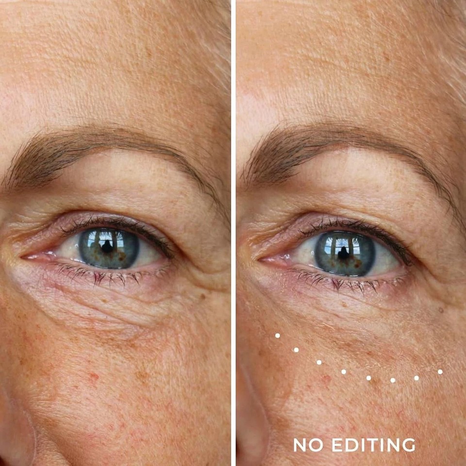 Wunderlift, 60 Second Wrinkle Reduce | eBay UK