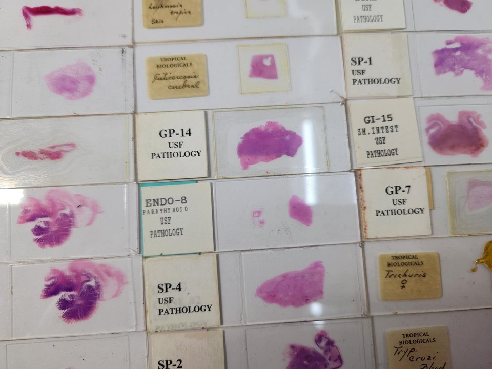 Lot Of 50 Vintage University Prepared Pathology Microscope Slides ...
