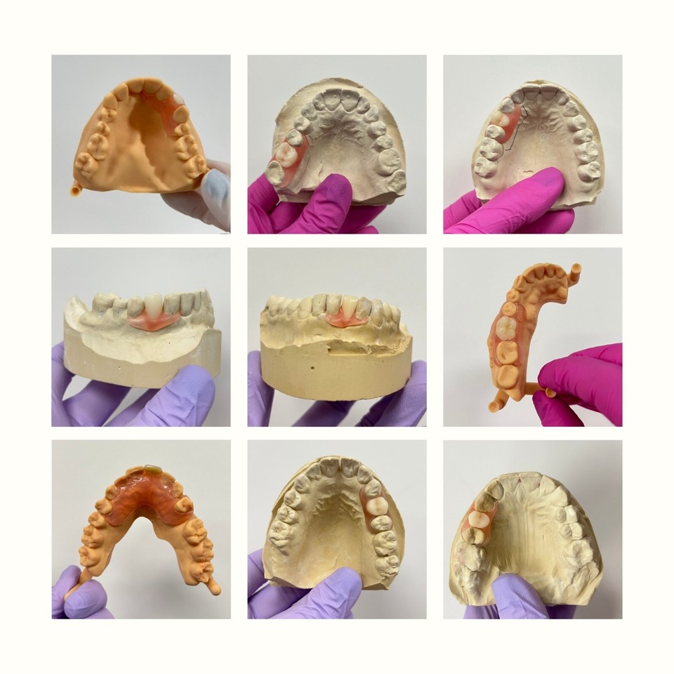 Nesbit, Flexi Flipper, Molar Flipper, Missing Canine Tooth, Flipper ...