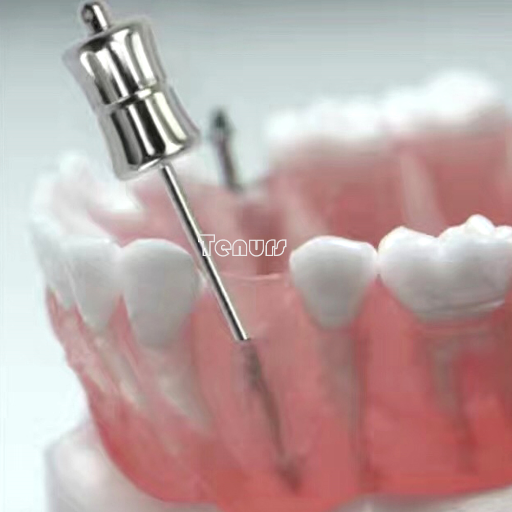 5pc dental Fragment Broken tooth root drill Remnant extractor anterior ...