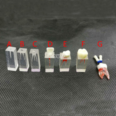 5pc Clear RCT Practice Model Resin Tooth Root Canal teach Model 7 ...