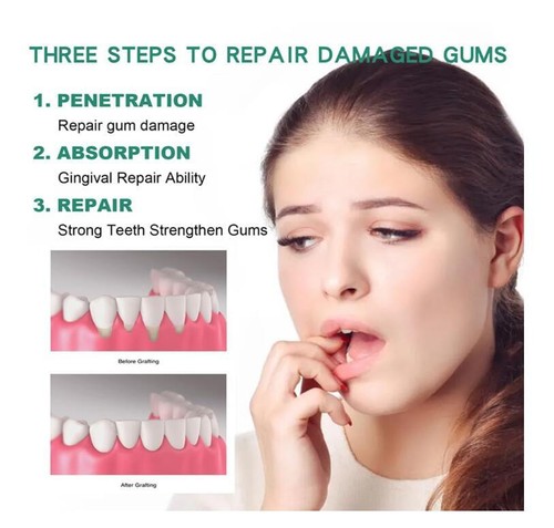 Denti zen Gum Regrowth Drops 30ml Treatment Natural For Oral Care ...