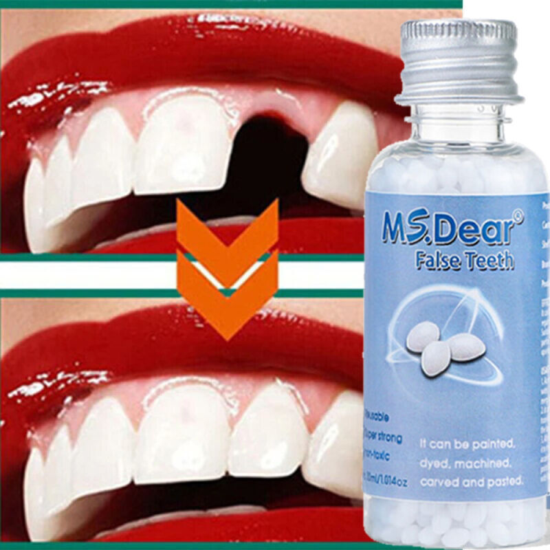 Temporary Tooth Repair Kit Teeth Gaps False Teeth Solid Glue Denture ...