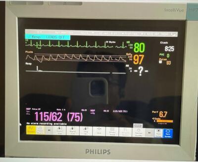 Patient Monitors - Intellivue