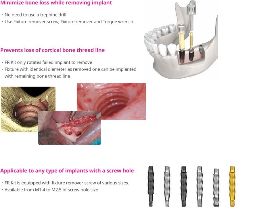 Universal Implant Fixture Removal Kit Neobiotech FR Style Implants ...