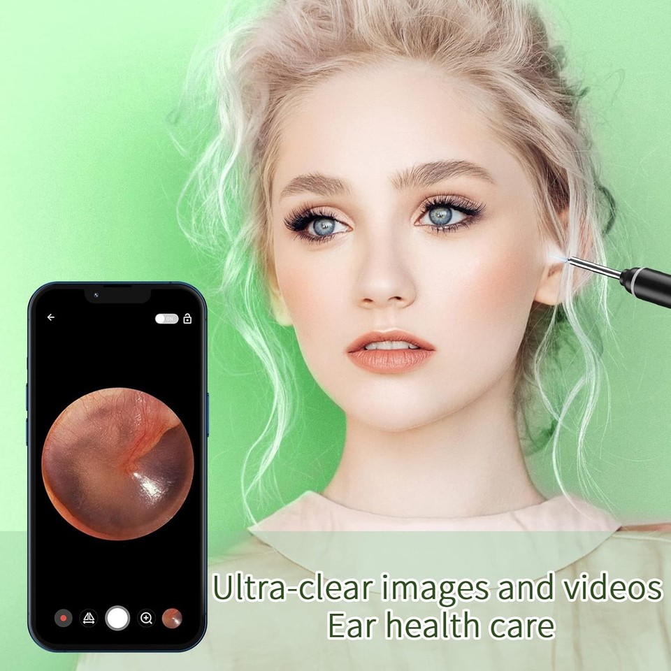 Multi-Purpose Ear Scope - 1920P HD Camera Otoscope w/ 6 LEDs for Home ...