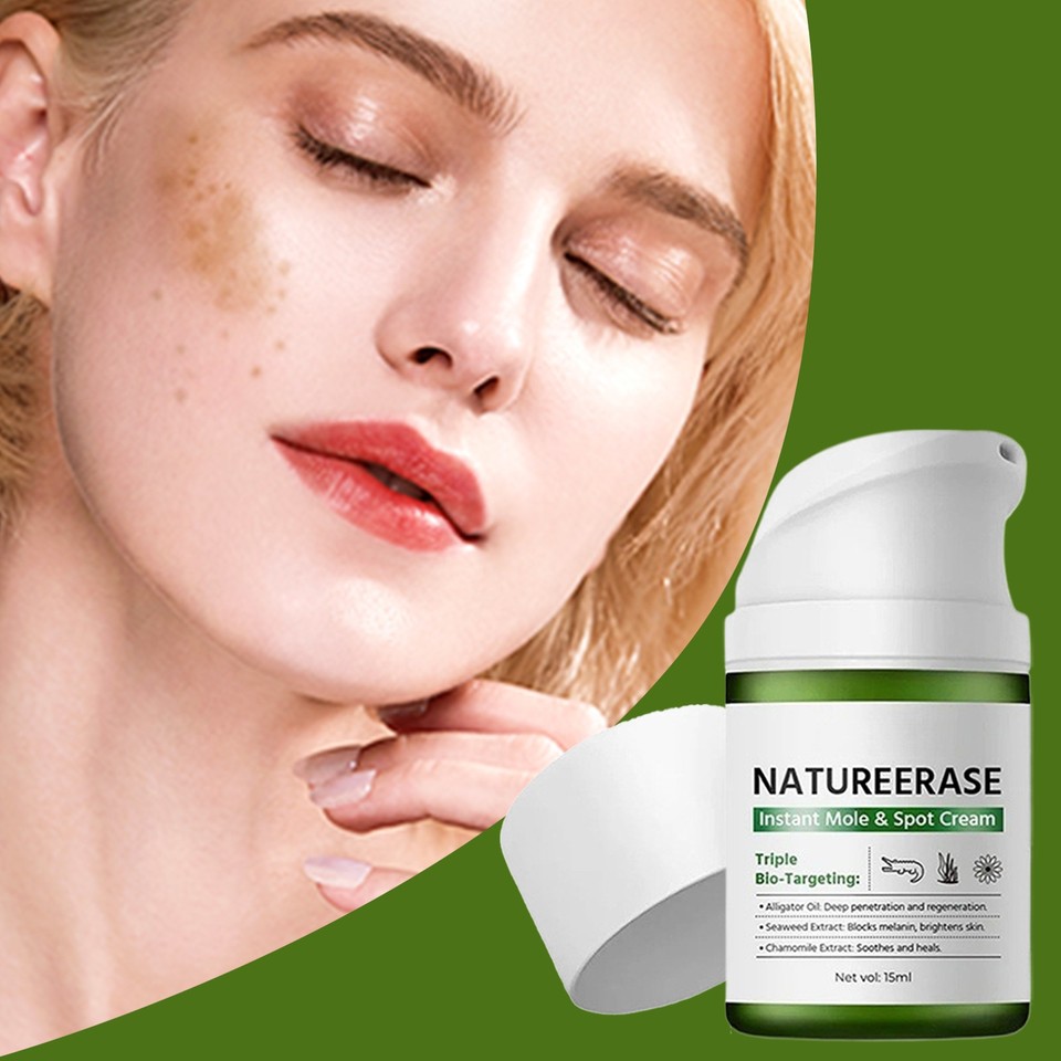 Mole Remover Cream Warts And Moles Removal 15ml Brightening Easy To Use ...