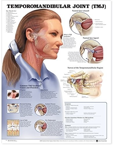TEMPOROMANDIBULAR JOINT (TMJ) ANATOMICAL CHART By Anatomical Chart ...
