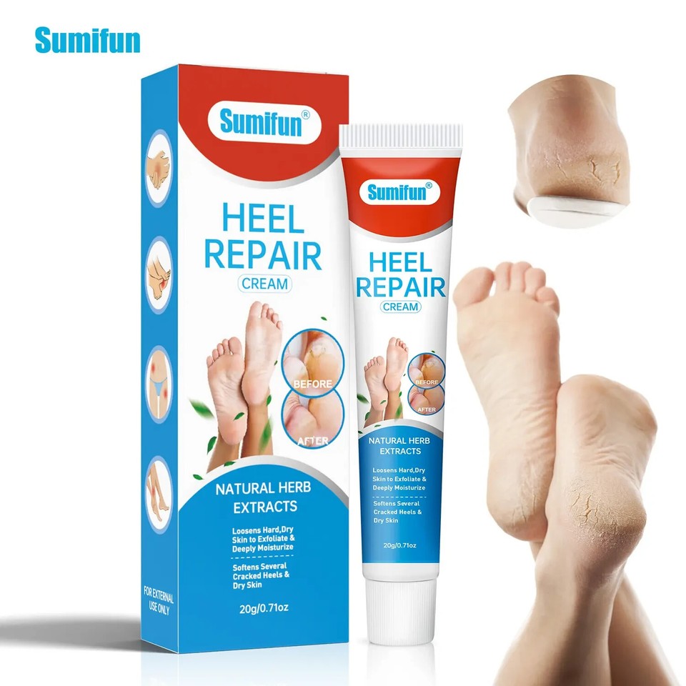 New Chilblain Hand Cream Anti-chapping Moisturizing Feet Winter Skin ...