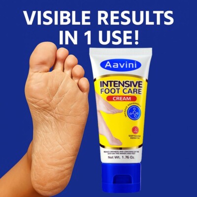 Cracked Heel Foot Cream 50g–Deep Moisture Repair, Odor Control & Callus ...