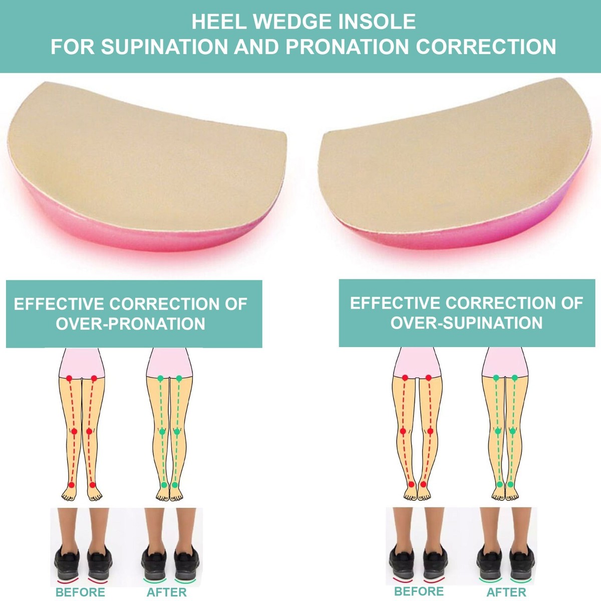 Over Supination Shoe Inserts