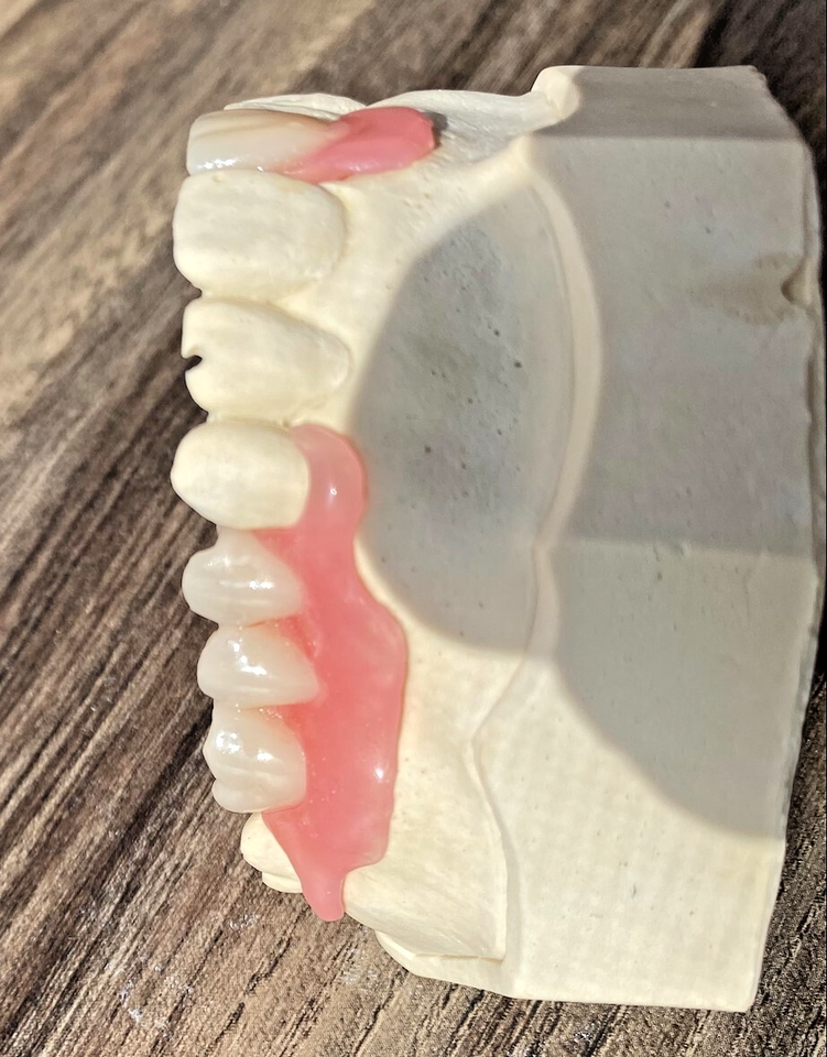 Custom Fit Flexible Flipper - Special Promotion (1 Flipper ) | eBay